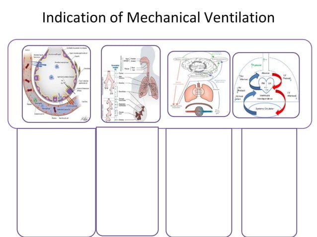 Basic Mechanical Ventilation.pptx