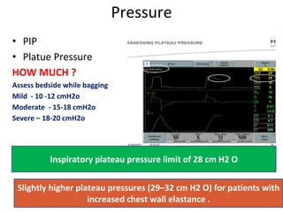 Basic Mechanical Ventilation.pptx
