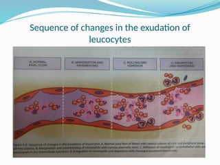 BASIC MECHANISM INVOLVED IN THE PROCESS OF INFLAMMATION (1)-1.pptx