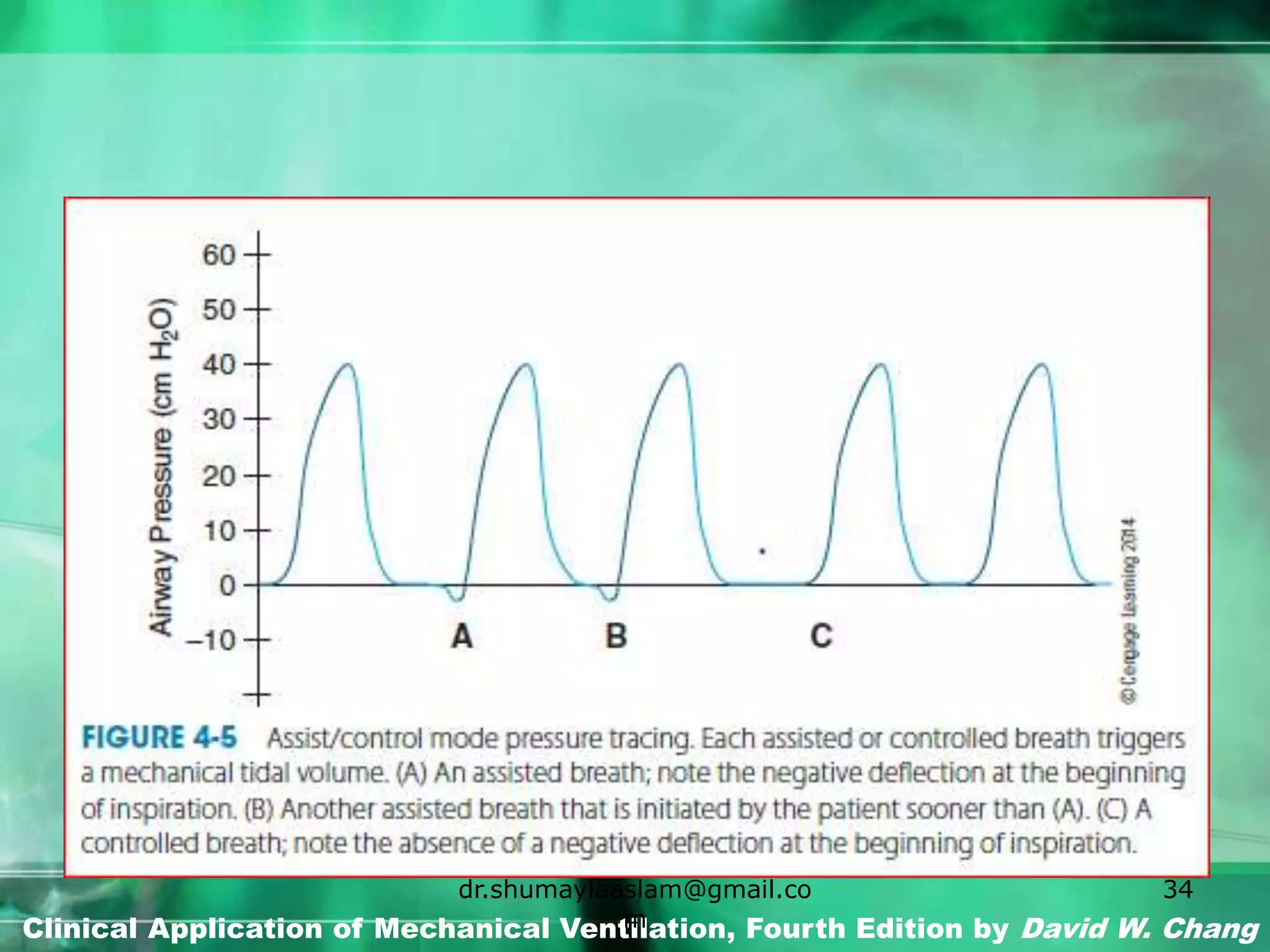 Basic mechanical ventilation settings | PPTX