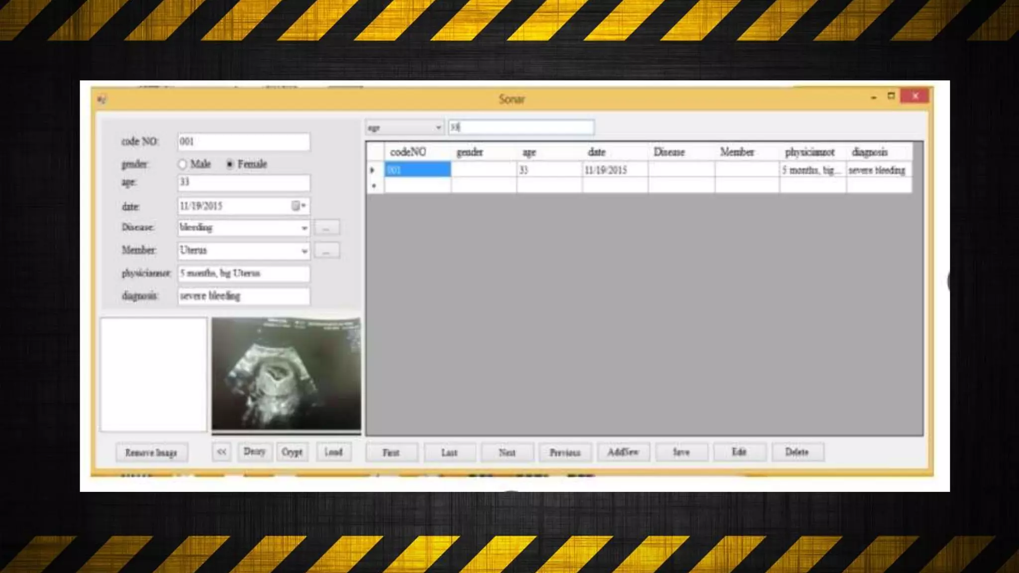Basic Medical Imaging Processing and Analysis | PPTX
