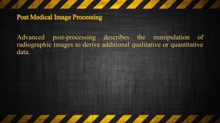 Basic Medical Imaging Processing and Analysis | PPTX