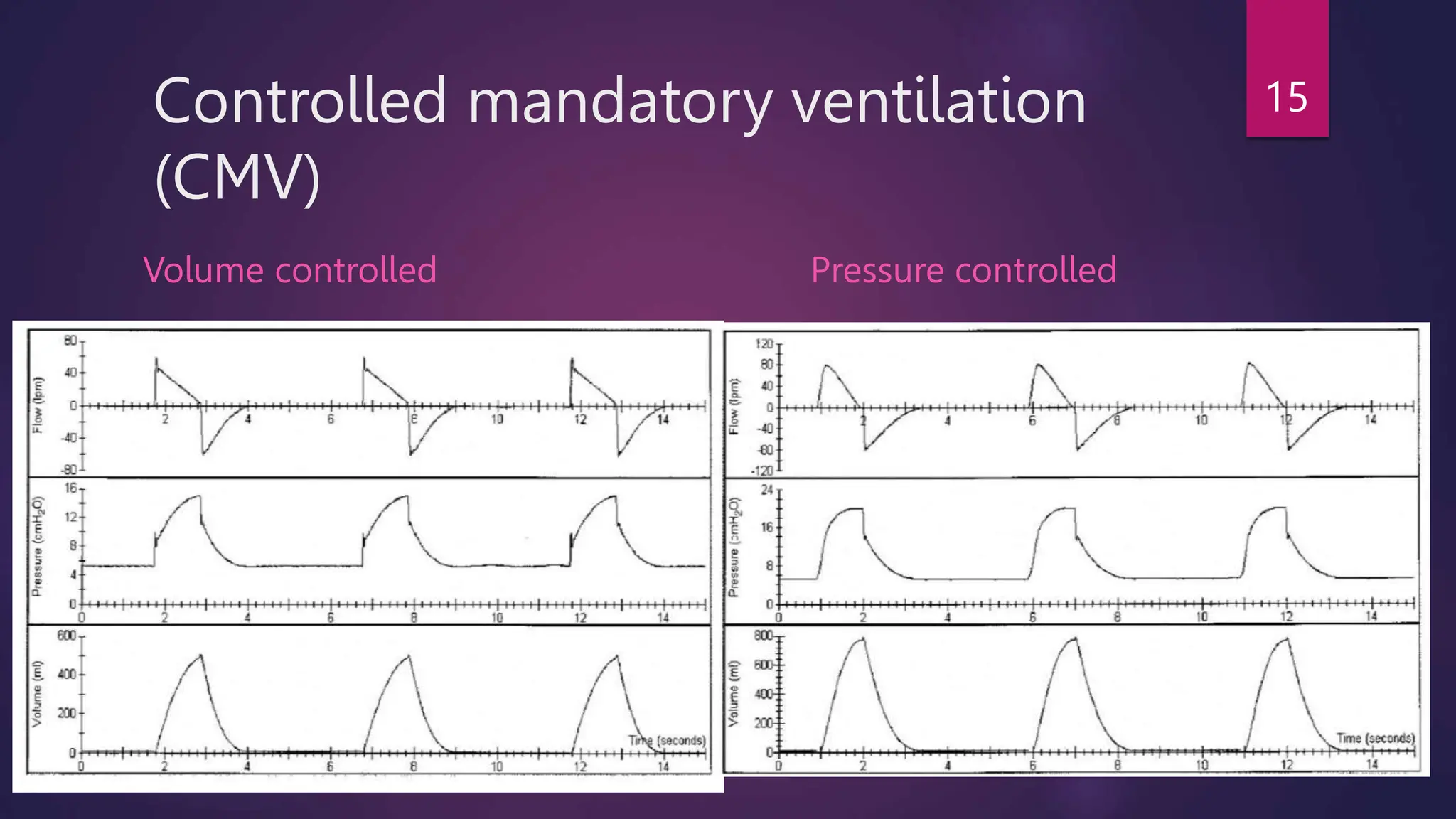 Basic mode of mechanical ventilation..pptx
