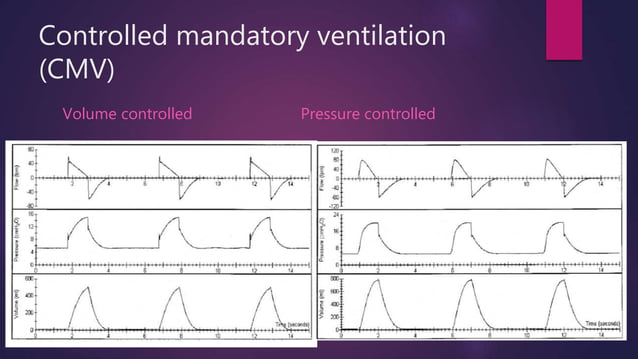 Basic modes of mechanical ventilation | PPTX | Lung and Respiratory ...