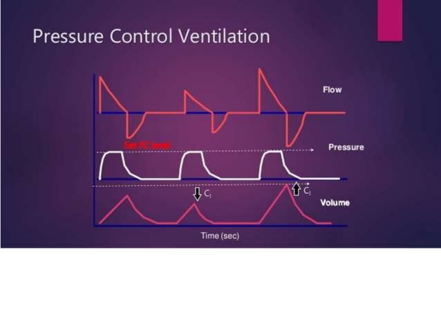 Basic modes of mv | PPTX