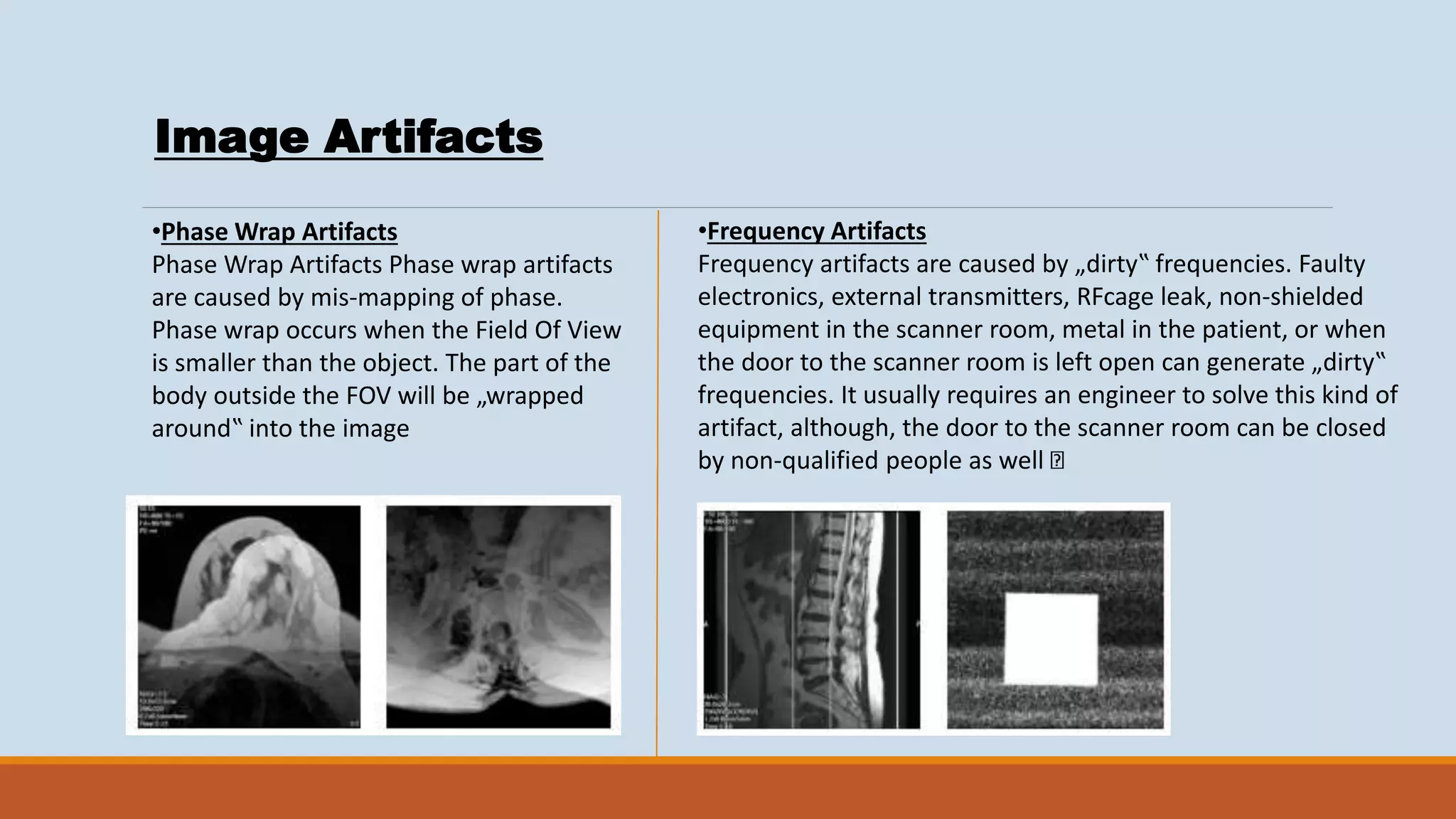 BASIC MRI.pptx