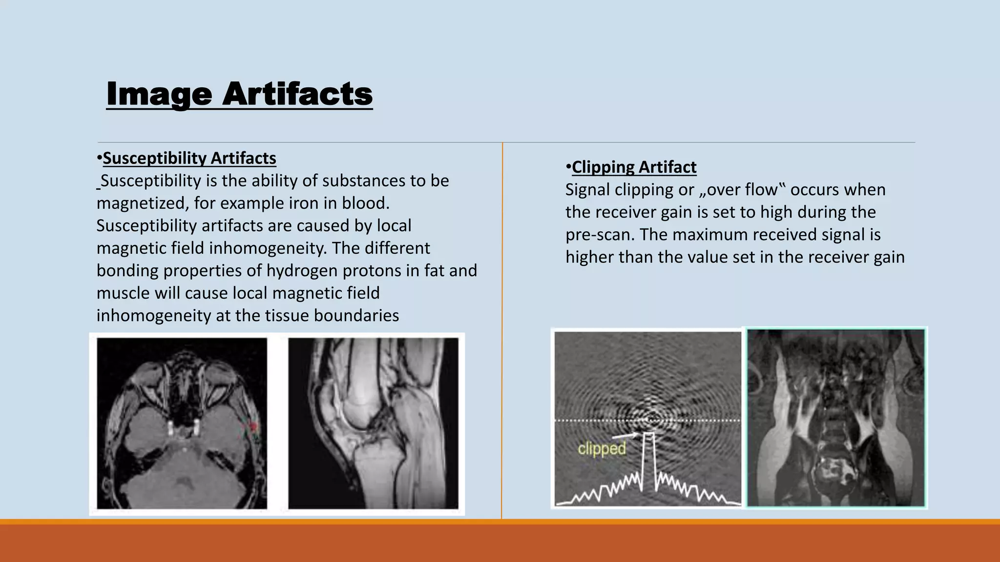 BASIC MRI.pptx