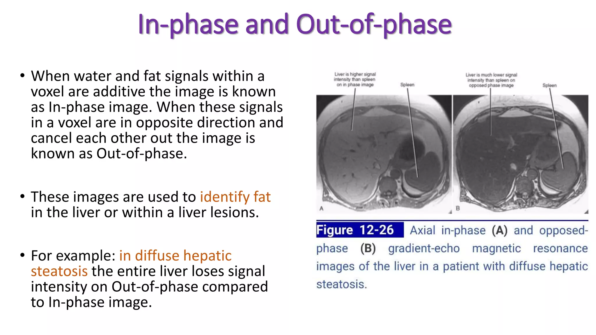 Basic MRI in hepatobiliary surgery.pptx