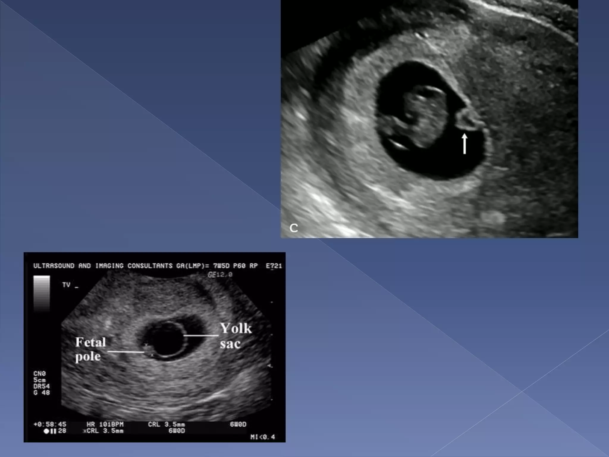 Basic Obstetric Ultrasound | PDF