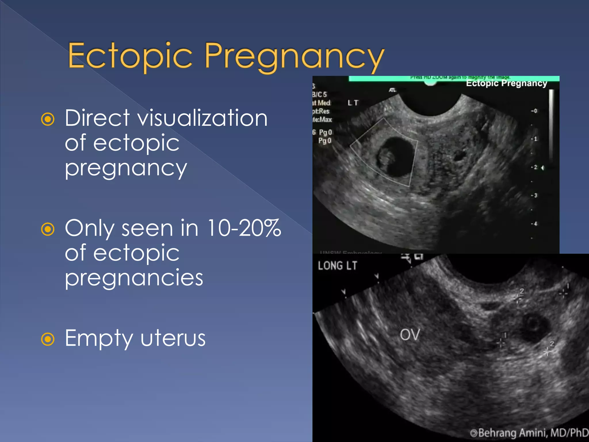 Basic Obstetric Ultrasound | PDF