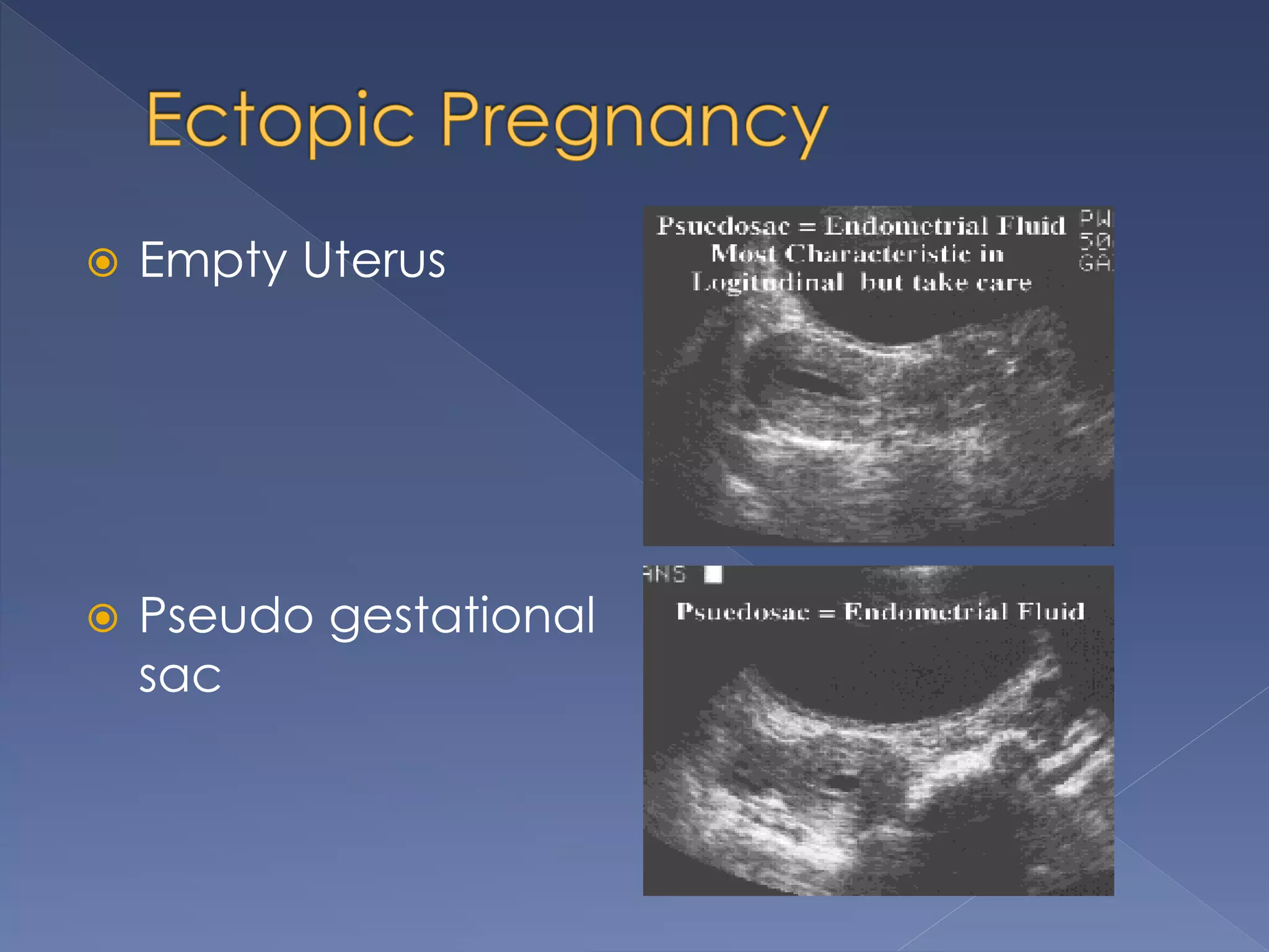 Basic Obstetric Ultrasound | PDF