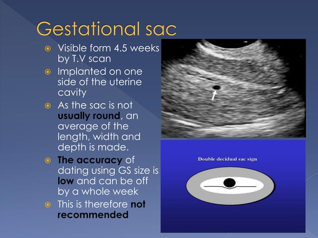 Basic Obstetric Ultrasound | PDF