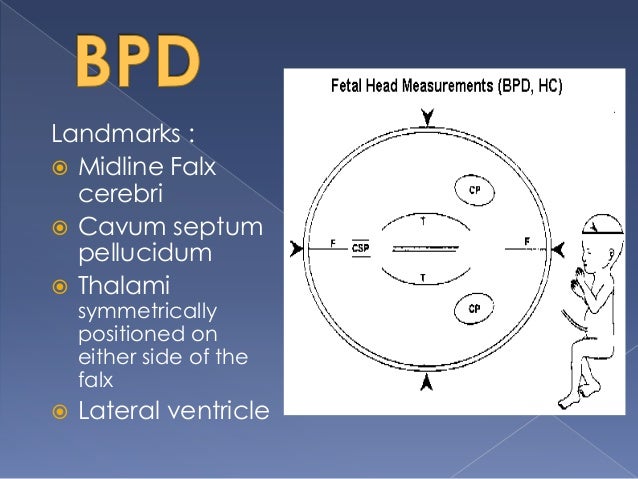 Basic Obstetric Ultrasound