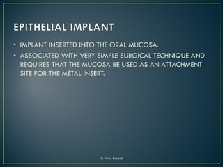 Basic of dental implant | PDF
