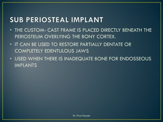 Basic of dental implant | PDF
