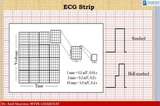 Basic of ecg interpretation | PPTX