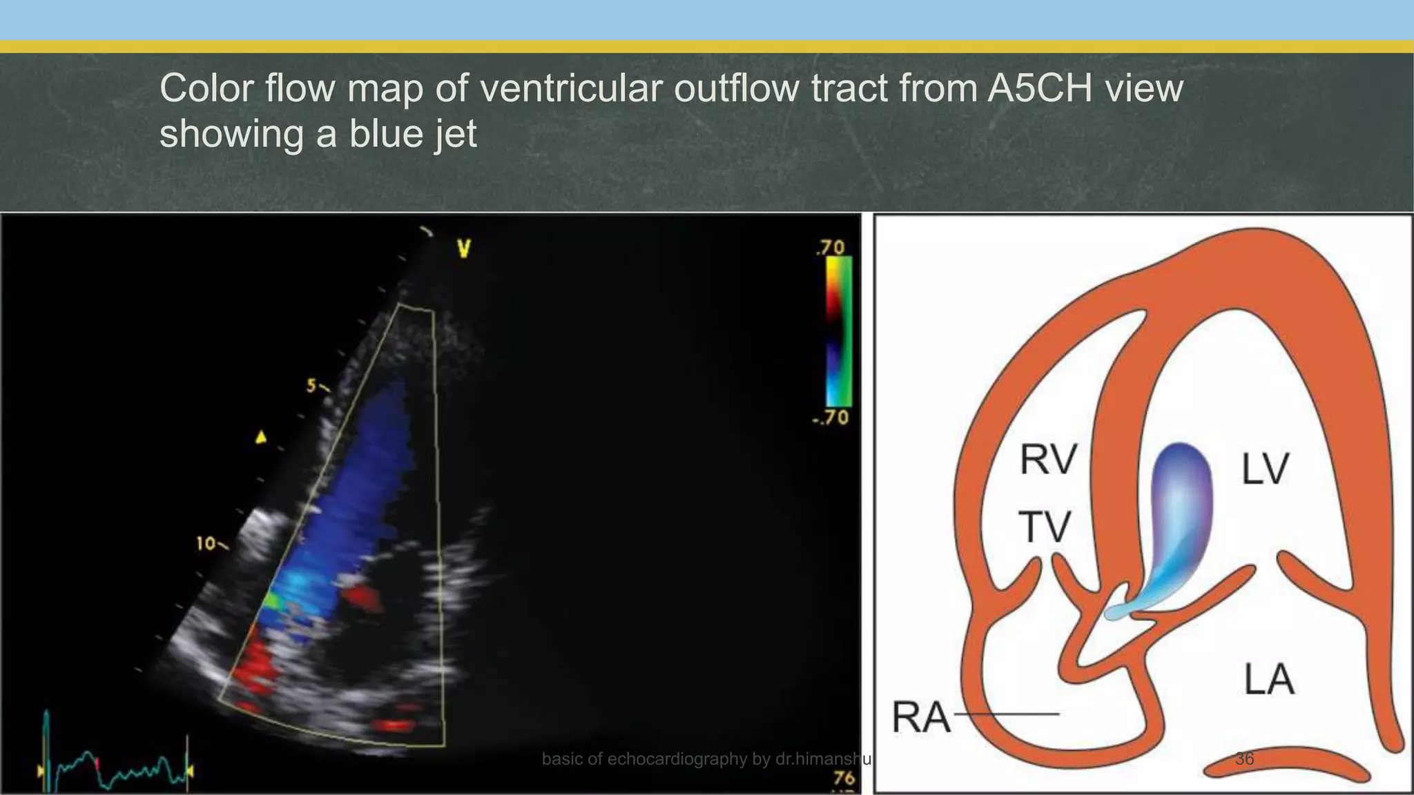 Echocardiography basics | PPTX