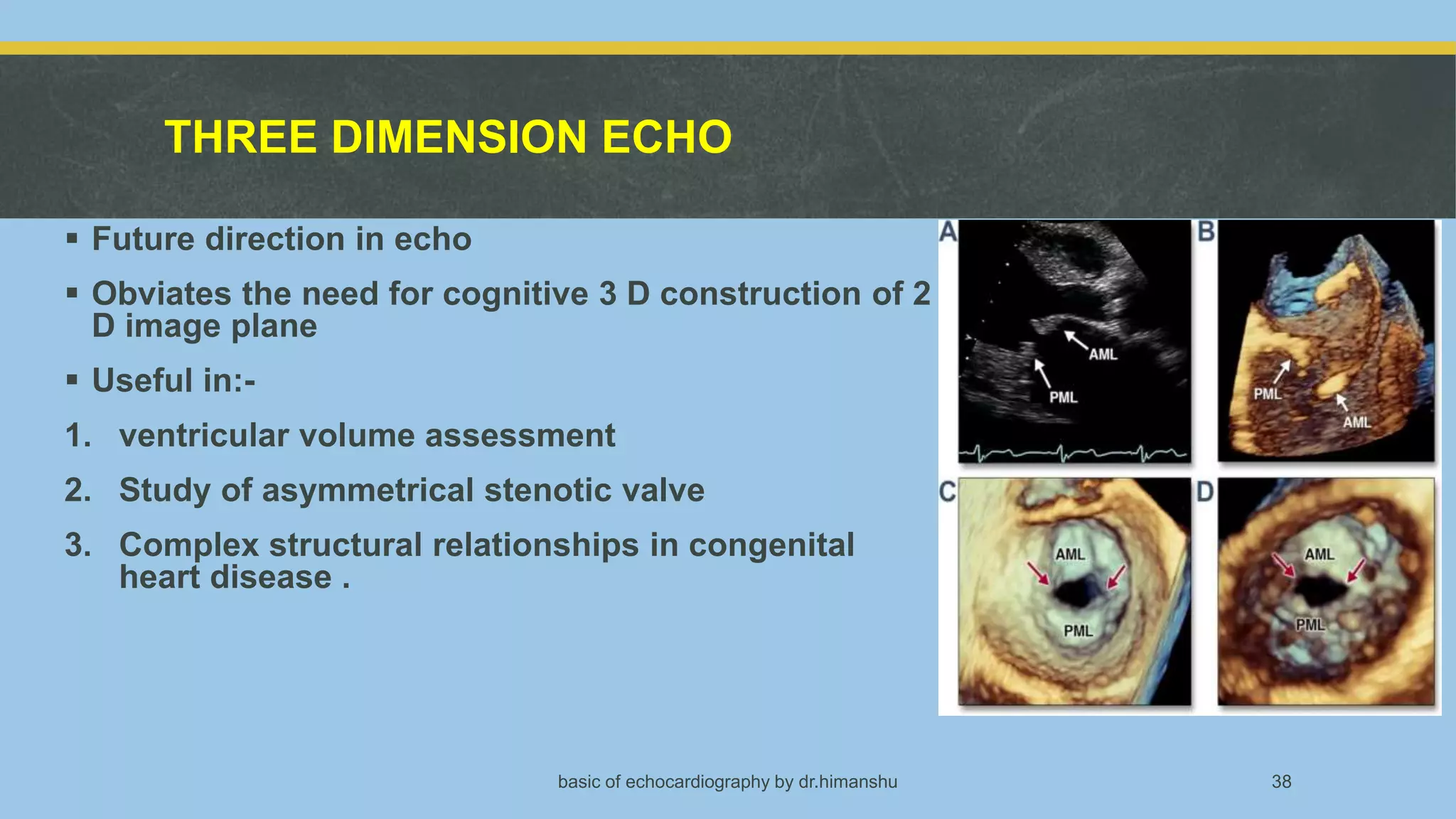 Echocardiography basics | PPTX