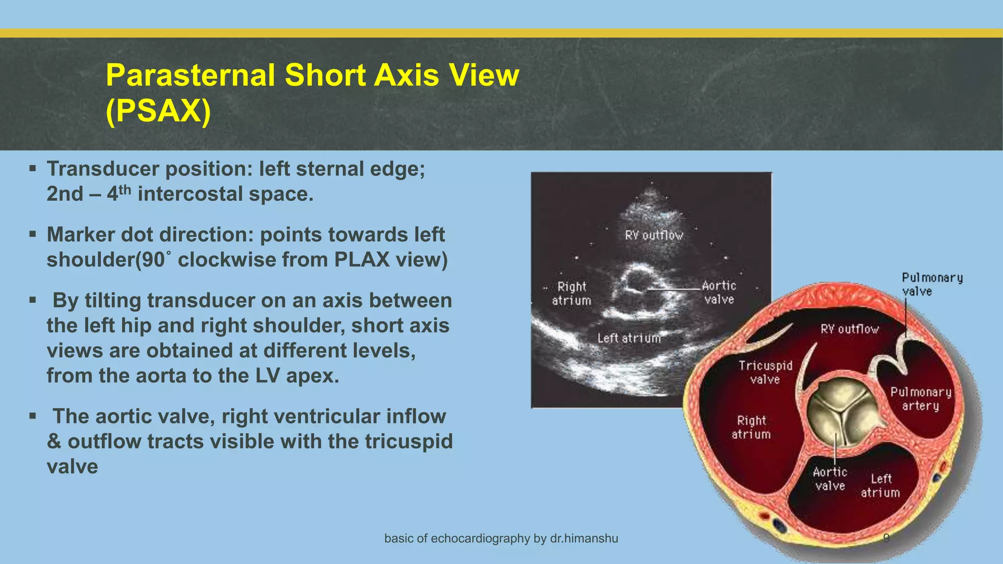 Echocardiography basics | PPTX