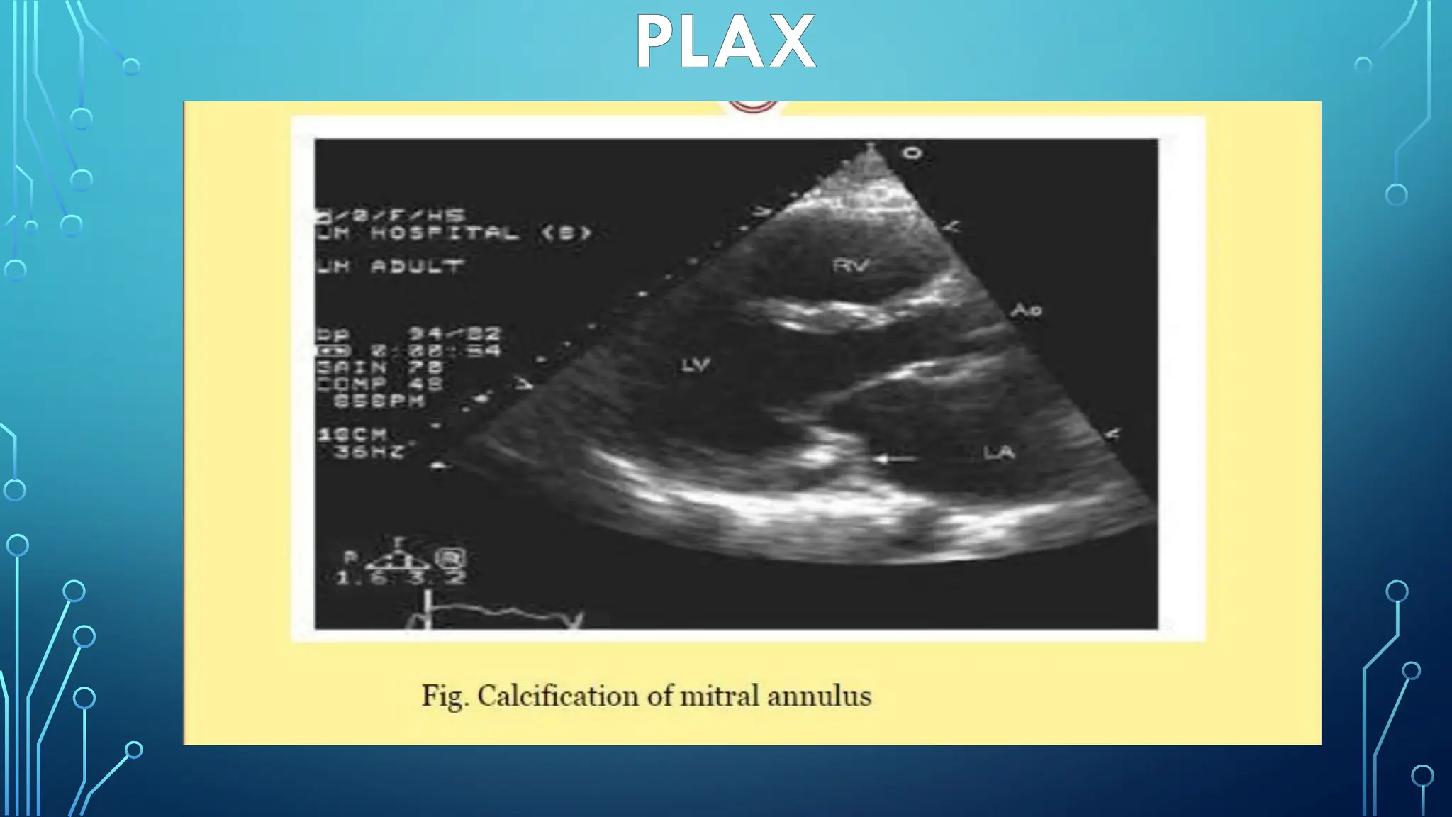 BASIC OF ECHOCARDIOGRAPHY nice to know.pptx