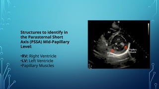 BASIC OF ECHOCARDIOGRAPHY nice to know.pptx