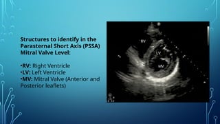 BASIC OF ECHOCARDIOGRAPHY nice to know.pptx
