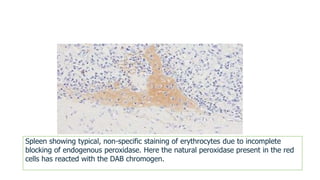 BASIC OF IHC BY GEORGE YEABYO-ETHIOPIA.pptx