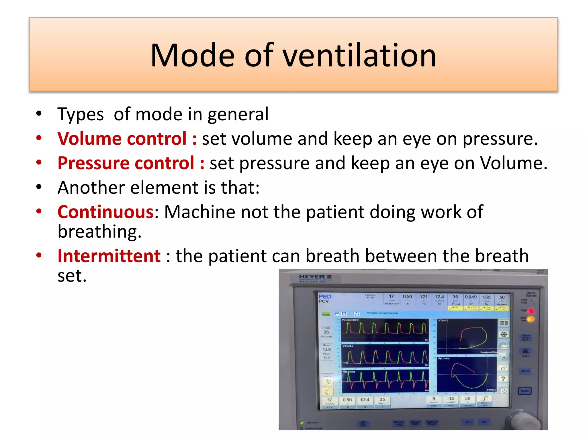 Basic of mechanical ventilation | PPTX