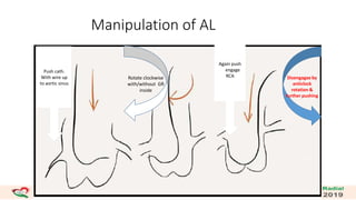 Basic of PCI through Trans Radial Route | PPTX | Heart and ...