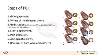 Basic of PCI through Trans Radial Route | PPTX | Heart and ...
