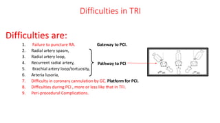 Basic of PCI through Trans Radial Route | PPTX | Heart and ...
