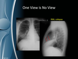 Basic of radiology | PPT