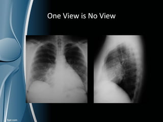 Basic of radiology | PPT