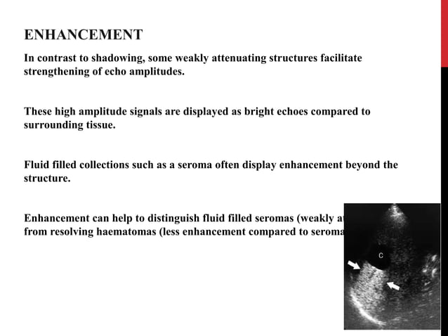 Basic of ultrasound | PPT