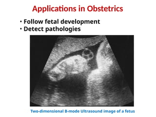 Basic of Ultrasound Imaging_powerpoint presentation | PPTX