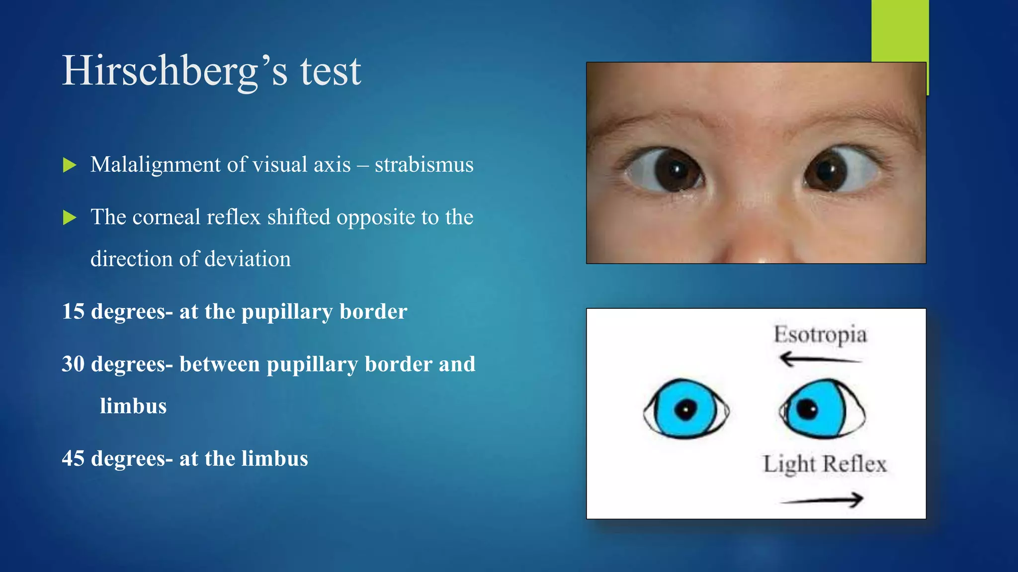Basic ophthalmological examination in OPD | PPTX