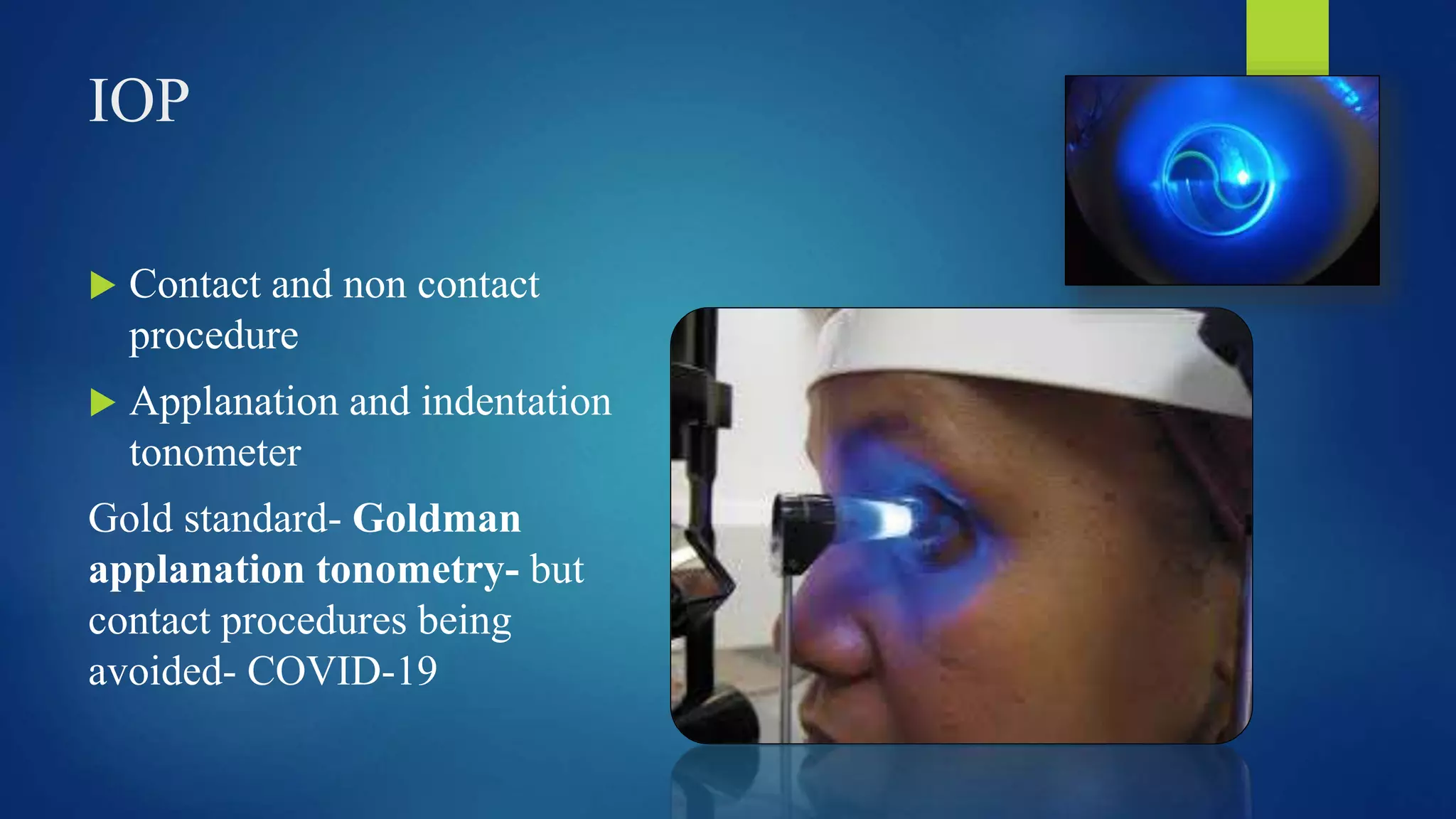 Basic ophthalmological examination in OPD | PPTX