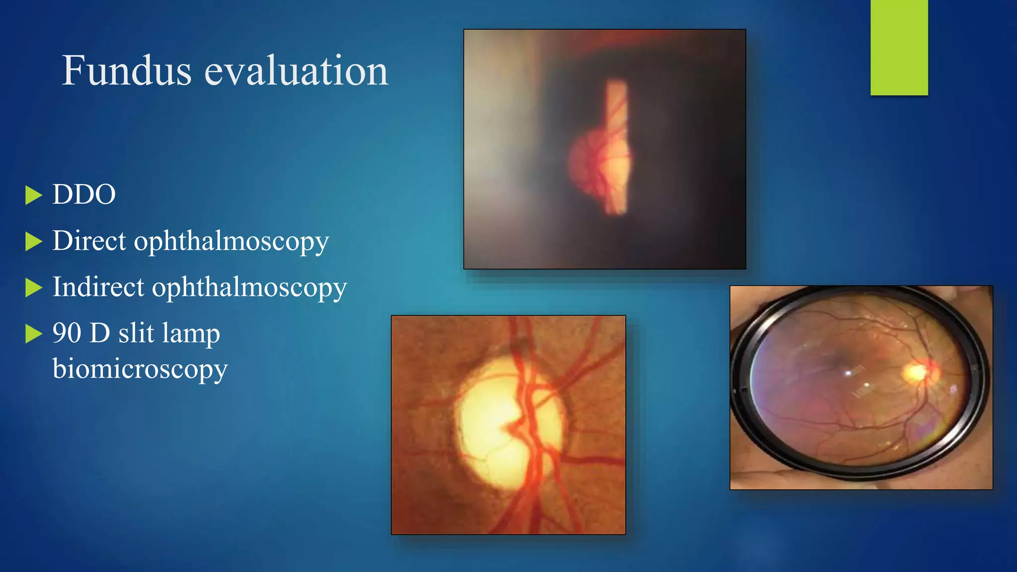 Basic ophthalmological examination in OPD | PPTX