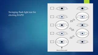 Basic ophthalmological examination in OPD | PPTX