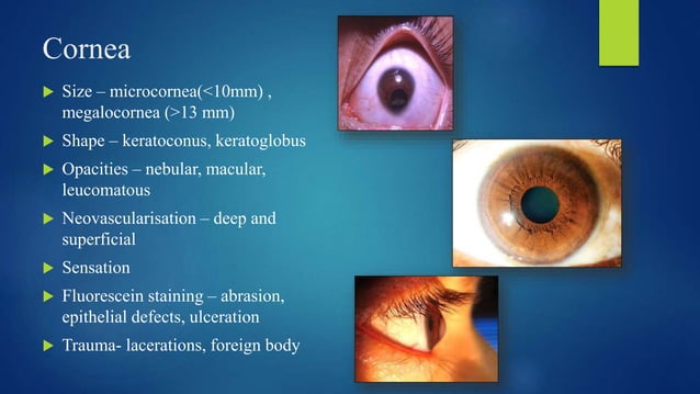 Basic ophthalmological examination in OPD | PPTX