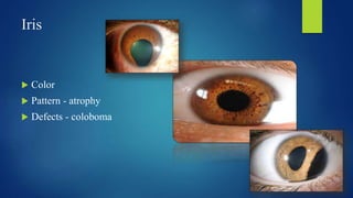 Basic ophthalmological examination in OPD | PPTX
