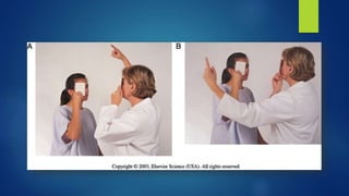 Basic ophthalmological examination in OPD | PPTX