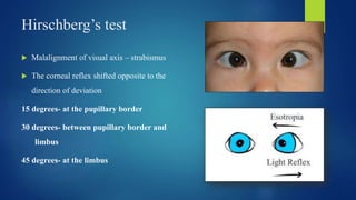 Basic ophthalmological examination in OPD | PPT