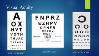 Basic ophthalmological examination in OPD | PPT