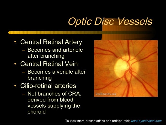 Basic opthalmoscopy findings - presentation at www.eyenirvaan.com