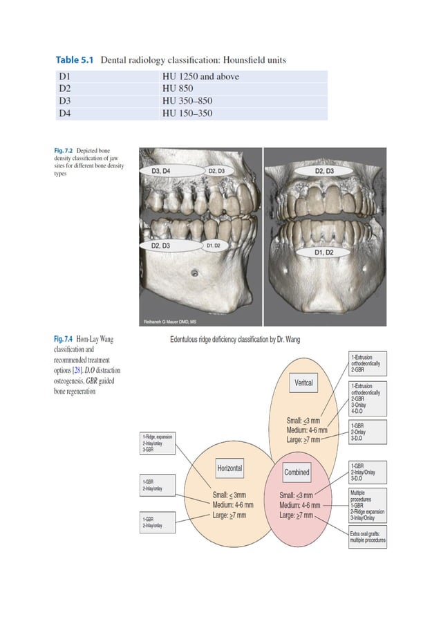 Basic Oral Implantology - new version 24.6.2024.pdf | Free Download