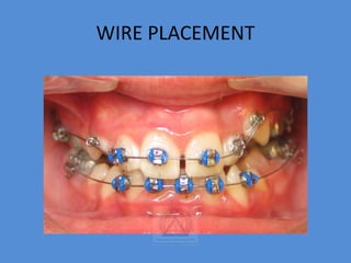 BASIC_ORTHODONTICS.pdf