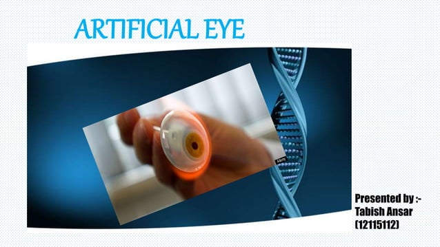 Basic overview of an artificial eye | PPT