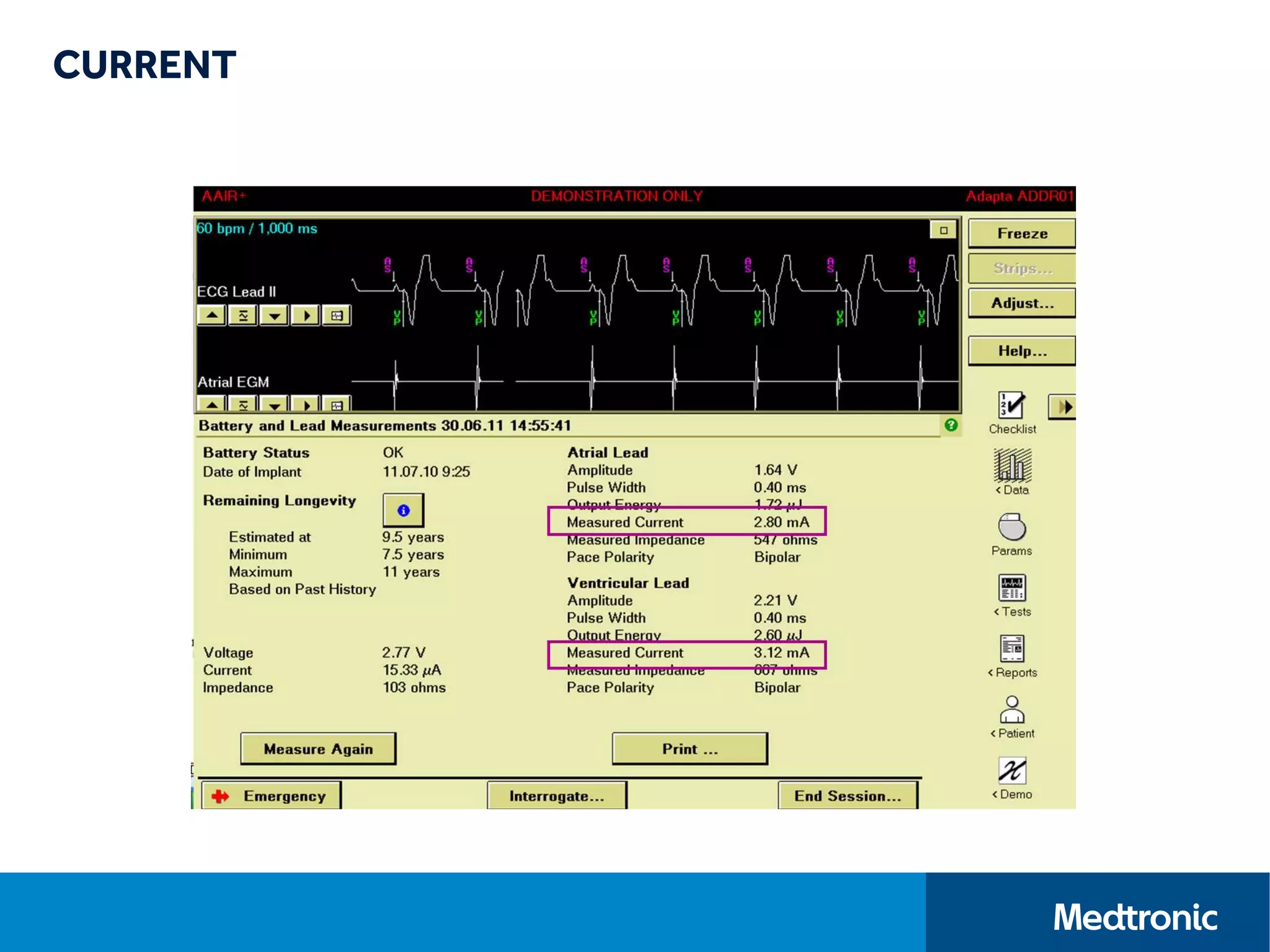 Basic pacing concepts | PPTX