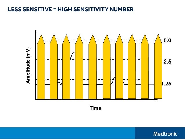 Basic pacing concepts